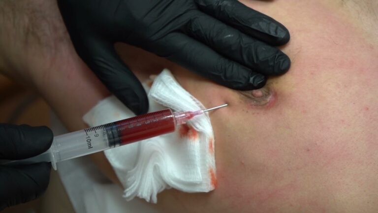 Skin Deep Sculpting – Houston's #1 Post Op Care & Lymphatic Massage